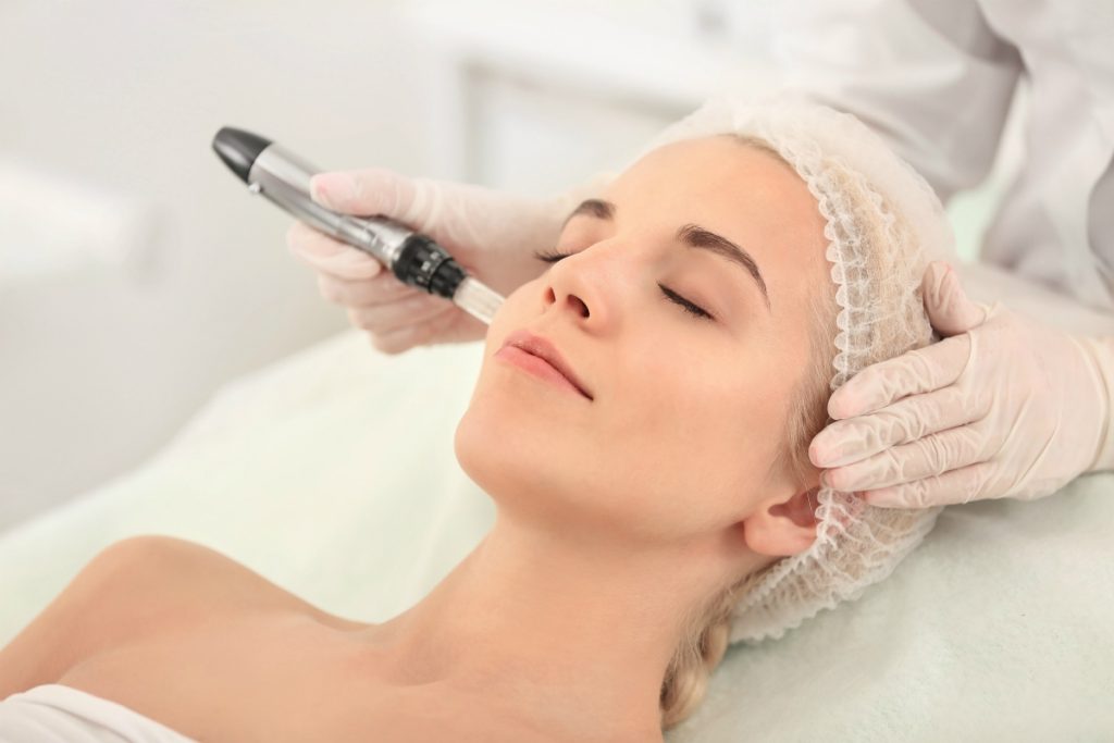 Skin Needling Broadway | Best Skin Needling Treatment